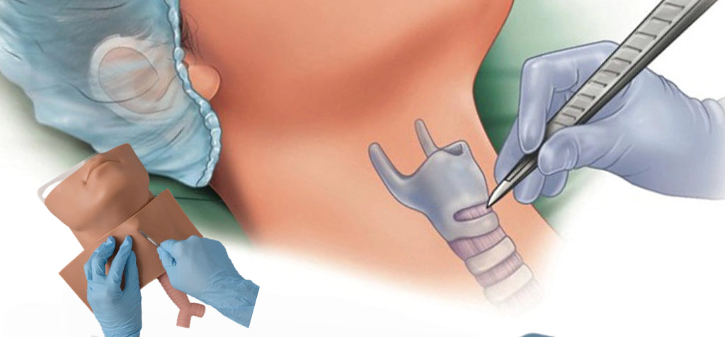 Emergency Cricothyrotomy: A Quick Guide – Medarchitect