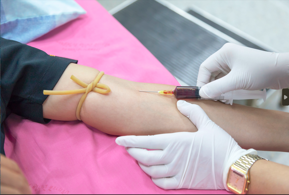 Should You Make a Fist When Getting An Injection? – Medarchitect