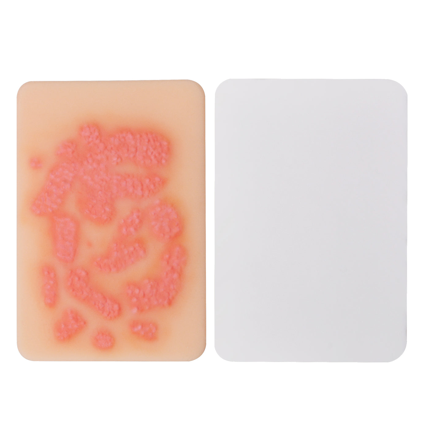Fungal Skin Infection Wound Simulation Models – Candida & Dermatophytes ...