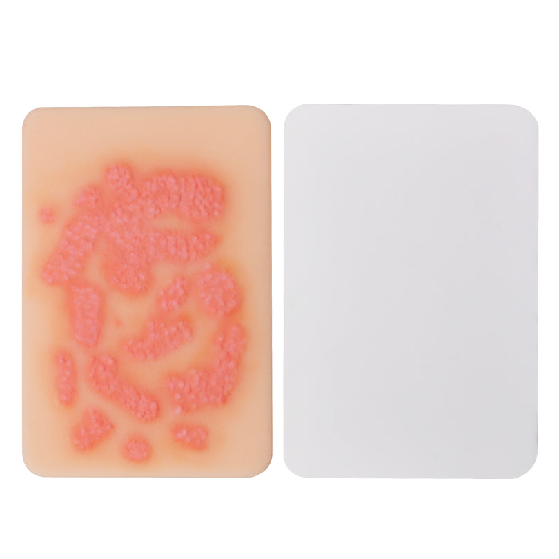 Fungal Skin Infection Wound Simulation Models – Candida & Dermatophytes ...