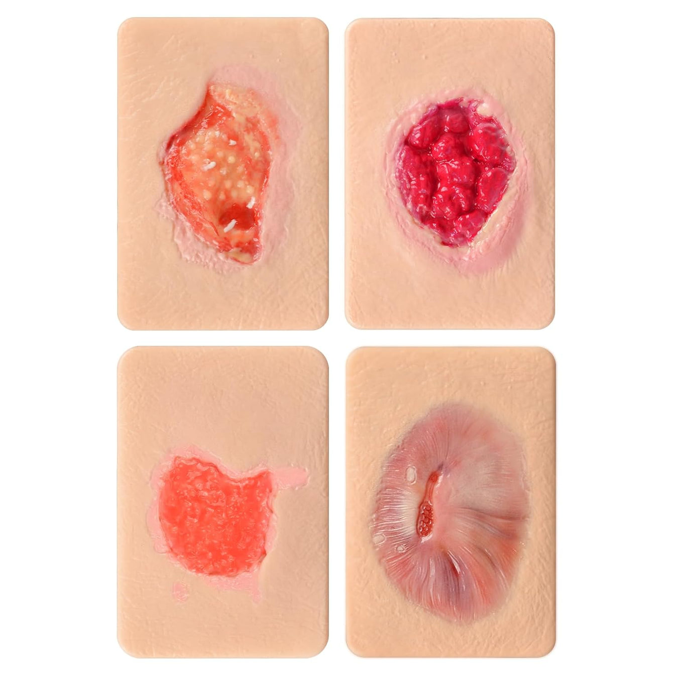 Granulation Tissue Wound Simulation Model Set (4 Pcs) – Medarchitect