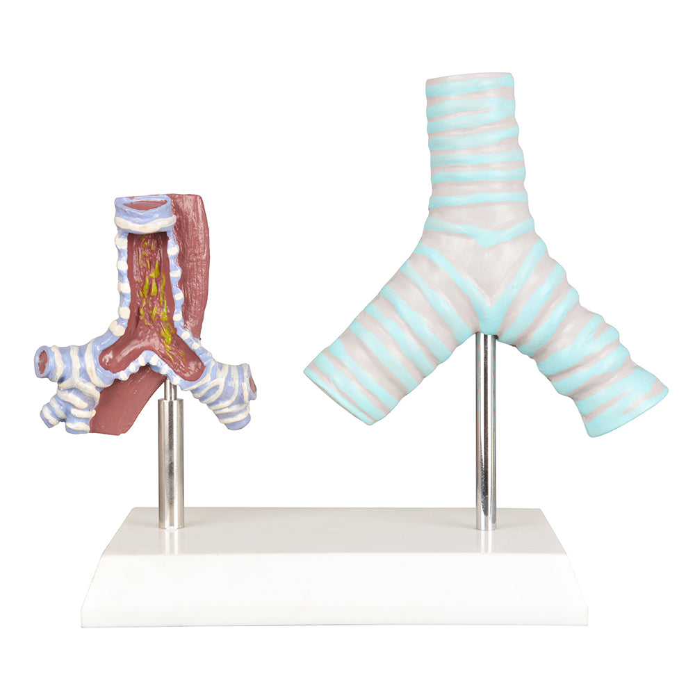Healthy vs. Smoker Human Bronchi Model – Medarchitect