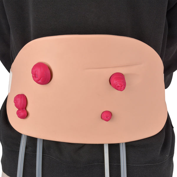 Wearable Ostomy Care Trainer – Medarchitect