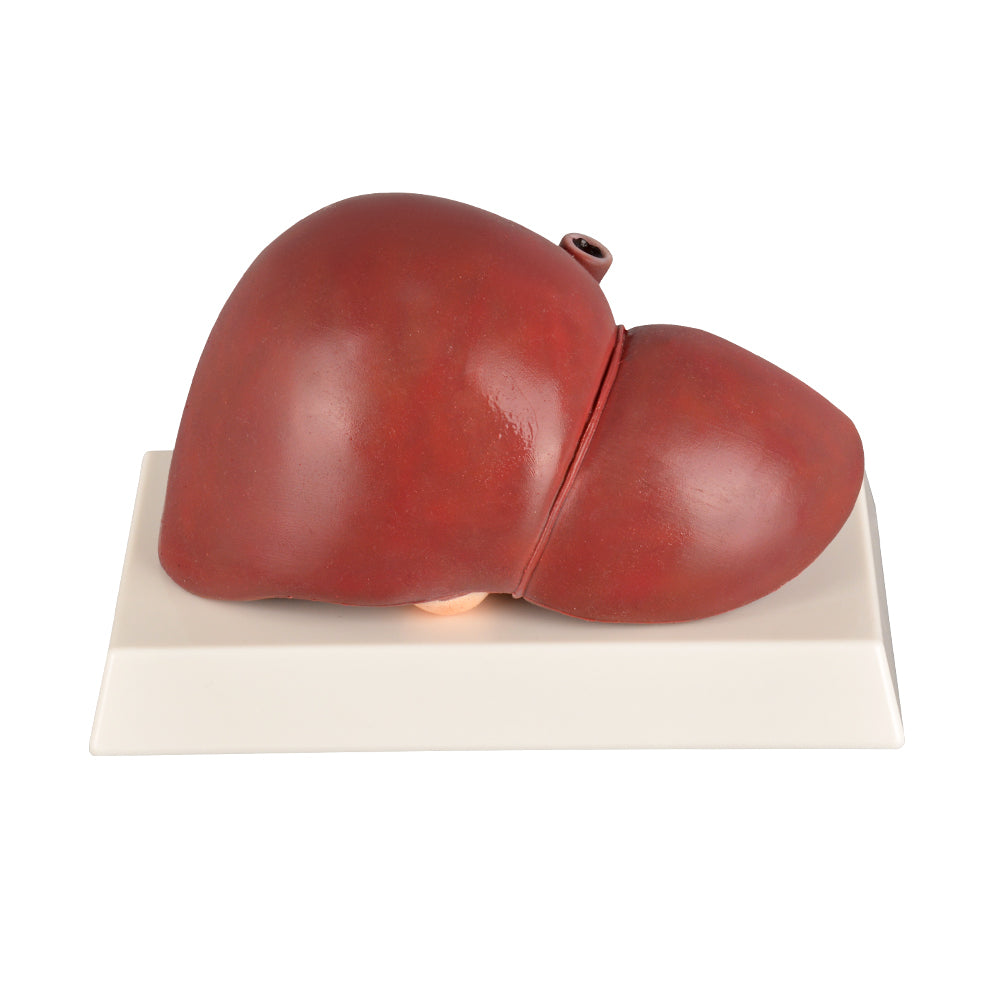 Normal Liver Model, Silicone – Medarchitect